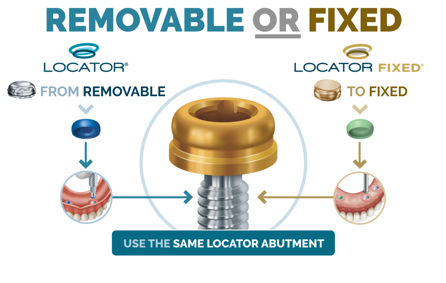 Nobel Biocare® - InnoVdentaire - Spécialiste implants / prothétiques